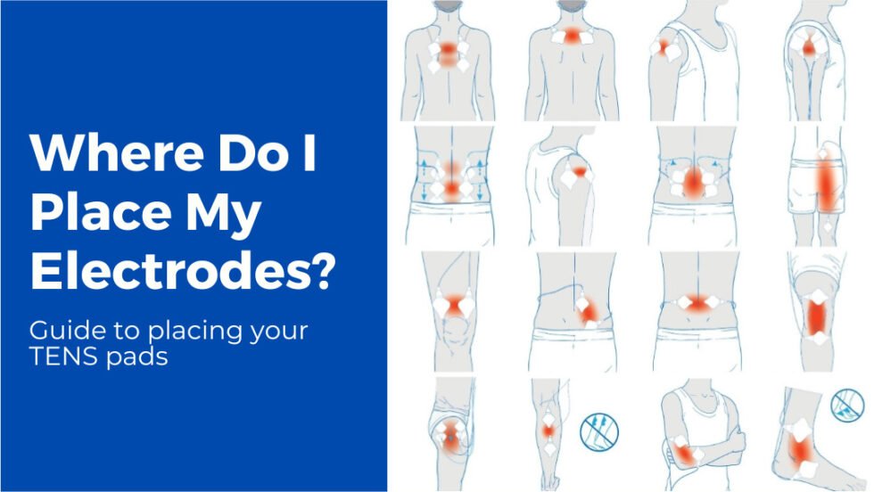 Where Do I Place My Electrodes? - TENS EMS UNIT